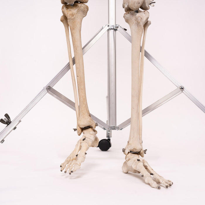 Real Skeleton Leg