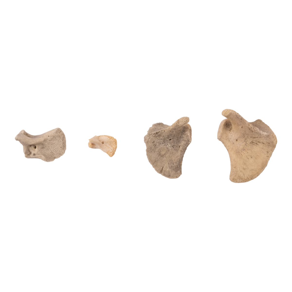 Real Research Quality Human Fetal Scapula For Sale — Skulls Unlimited ...